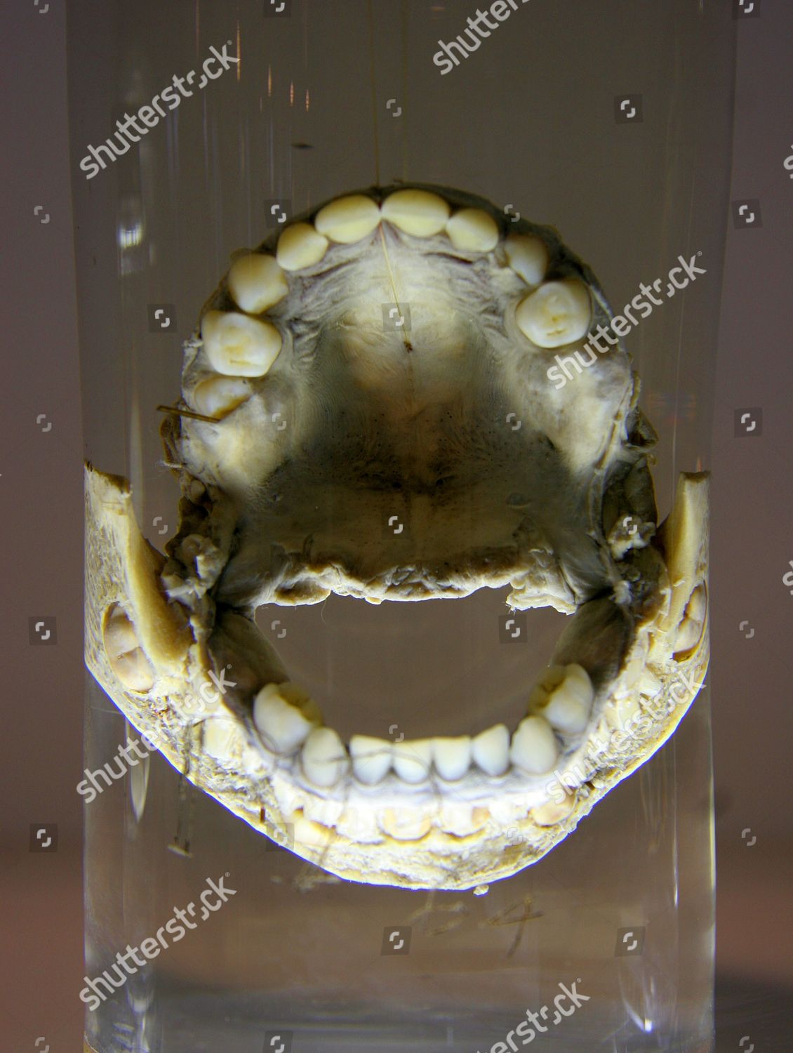 Human Jaw Bone Teeth One Medical Editorial Stock Photo - Stock Image ...