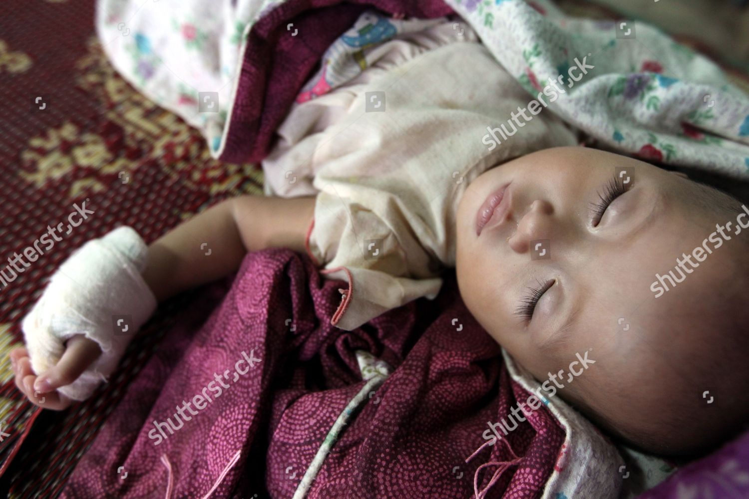 Sick Kayin Karen Refugee Baby Myanmar Editorial Stock Photo - Stock ...