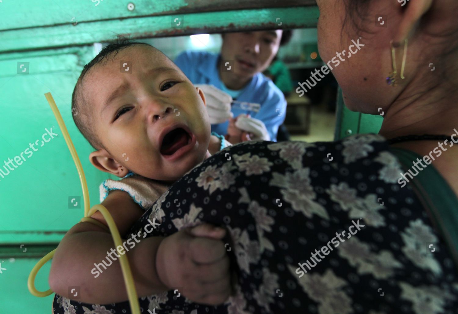 Sick Kayin Karen Refugee Baby Myanmar Editorial Stock Photo - Stock ...