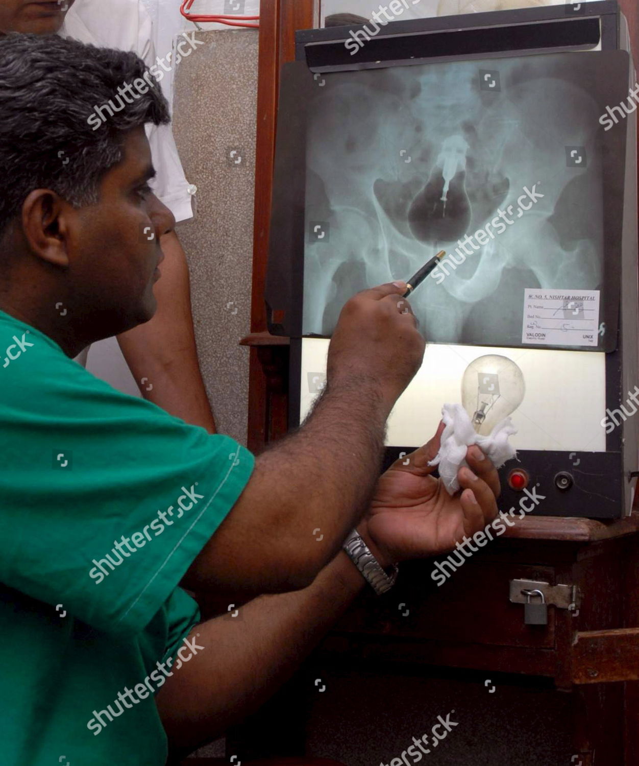 Doctors Holds Fused Bulb Which Recovered Editorial Stock Photo - Stock ...