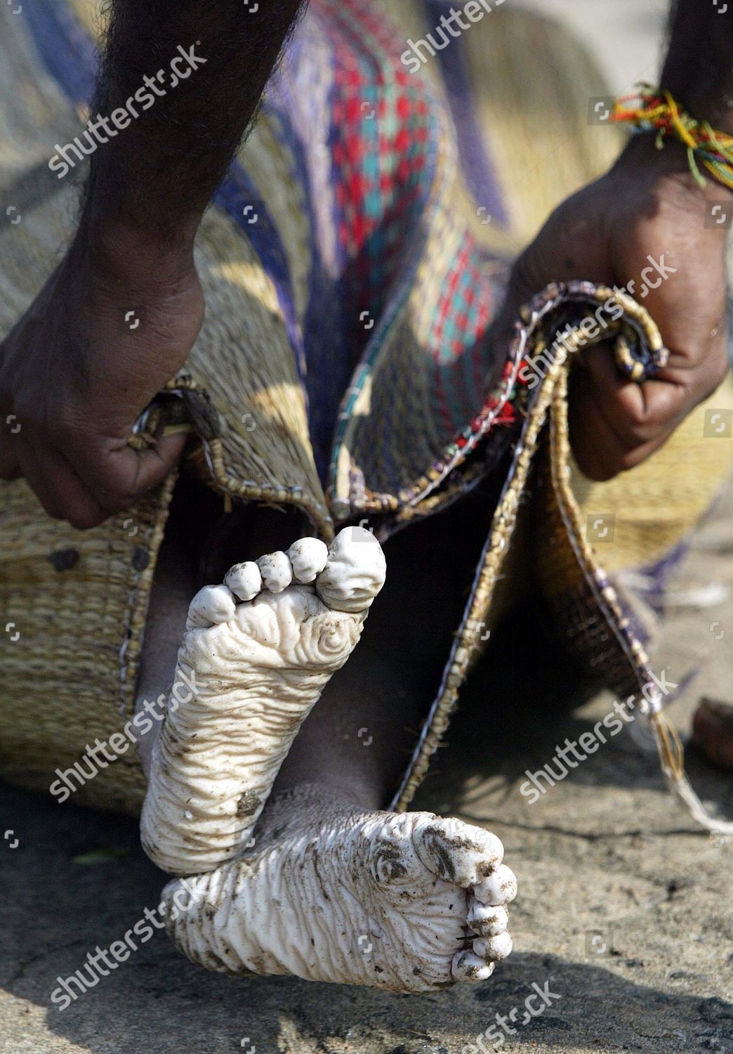 Volunteers Carry Decomposed Body Young Boy Editorial Stock Photo ...