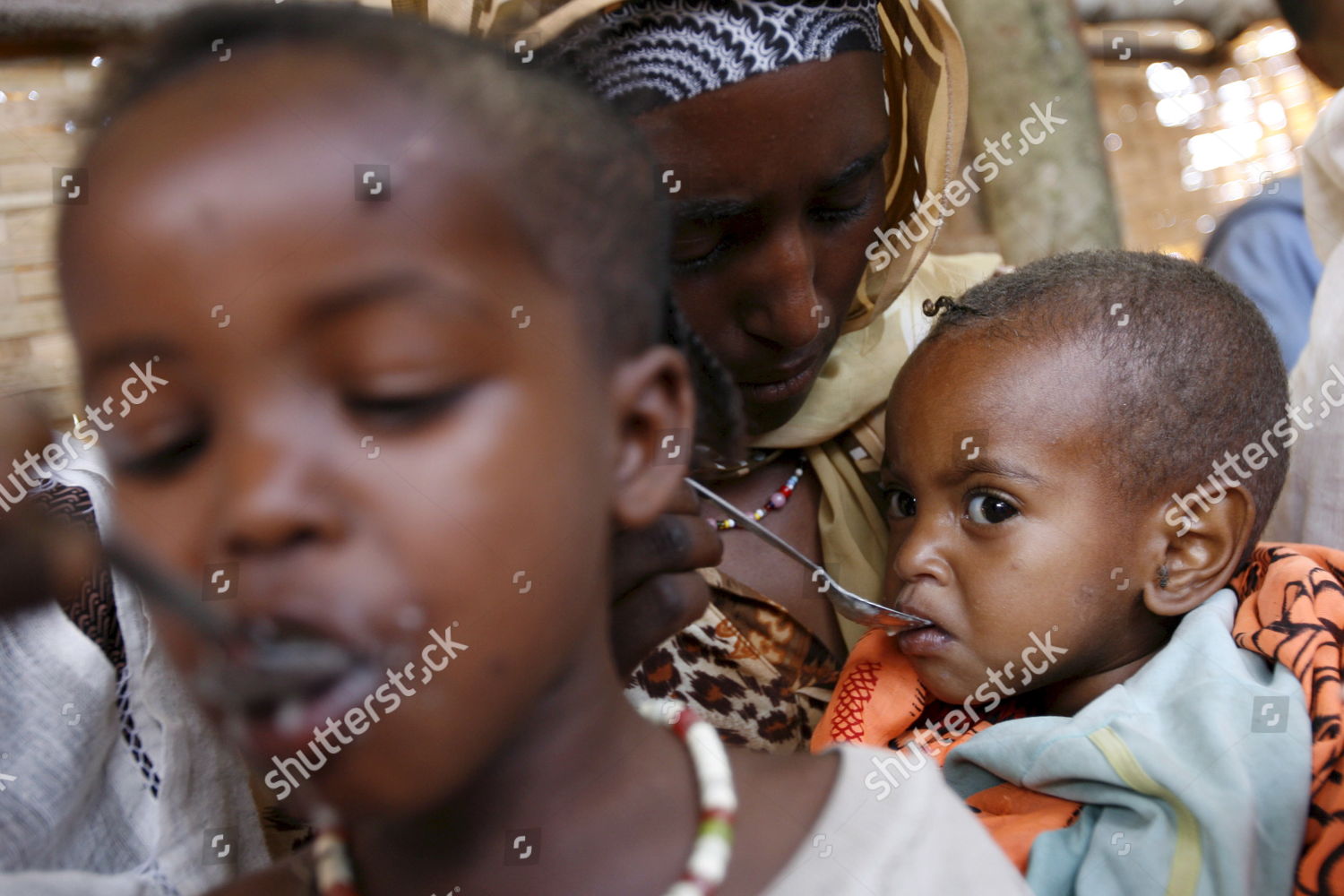 Malnourished Ethiopian Children Receive Mutimix High Editorial Stock ...