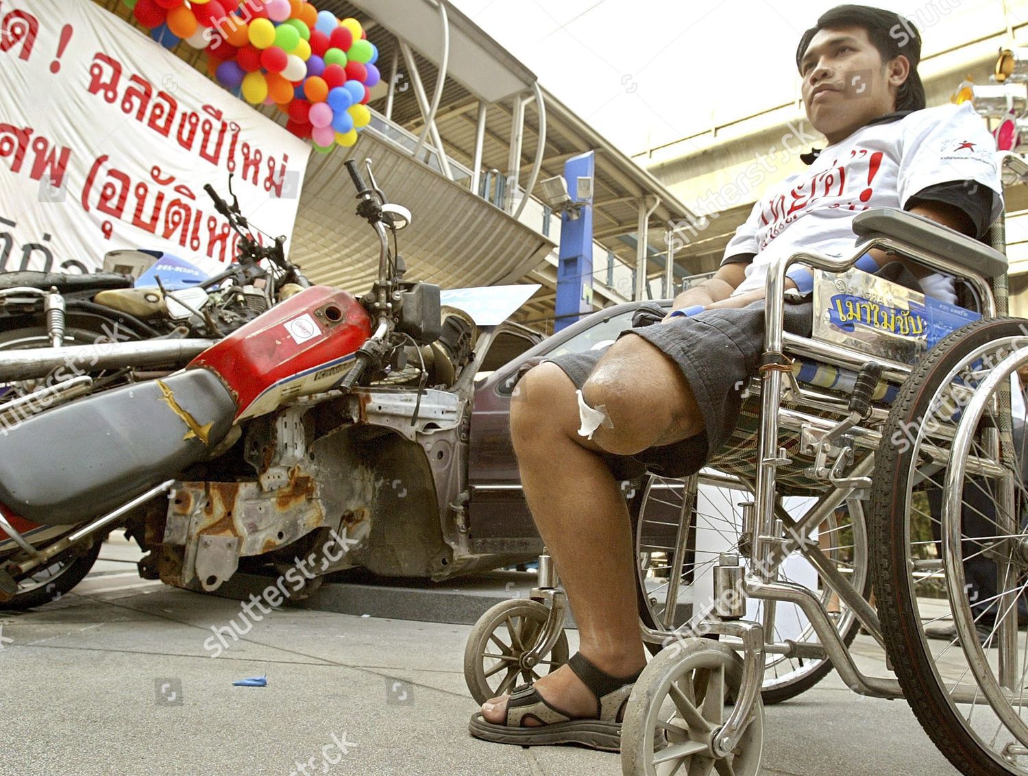 Thai Man Who Lost His Leg Editorial Stock Photo - Stock Image ...