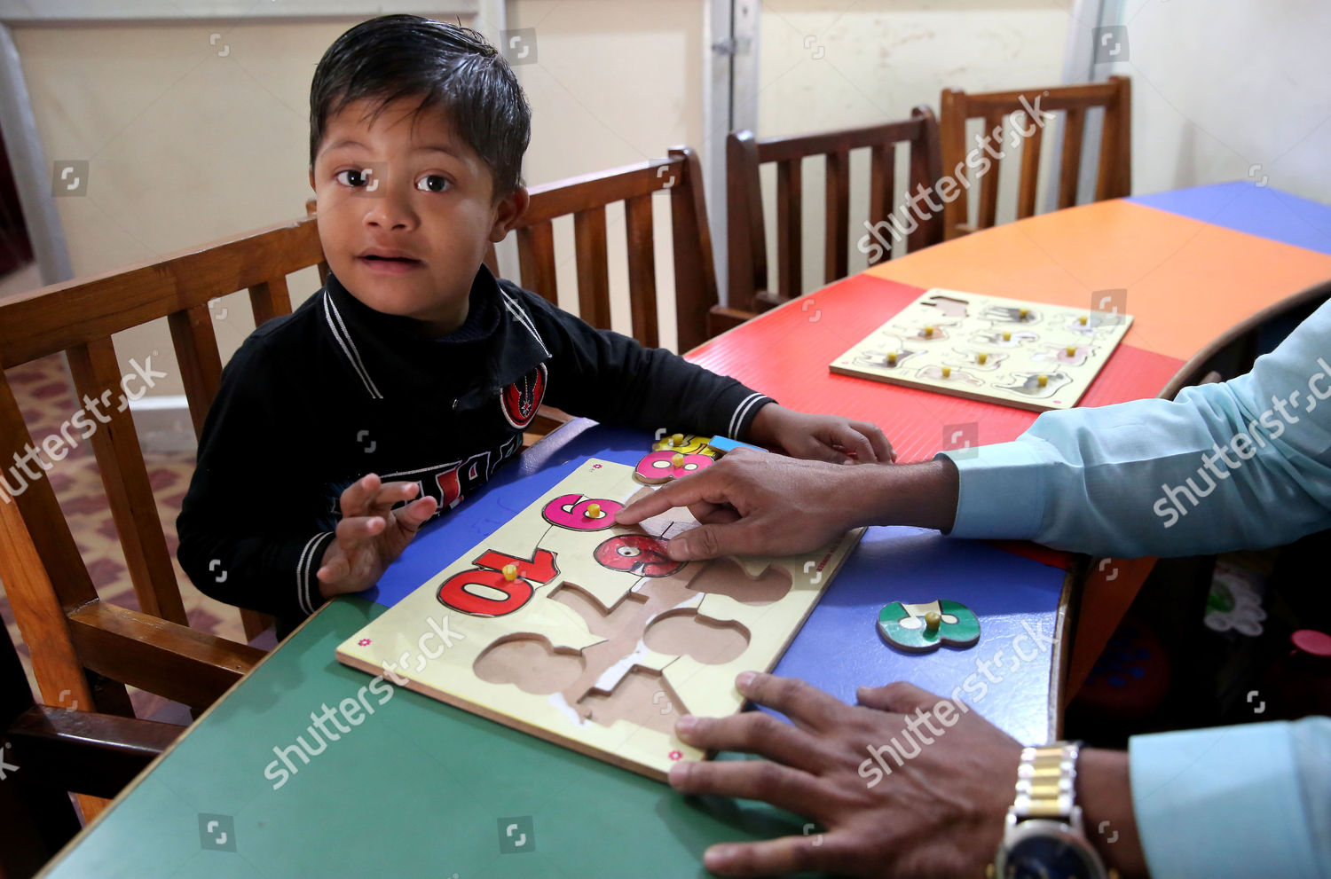 Child Born Congenital Disabilities Believed Be Editorial Stock Photo ...