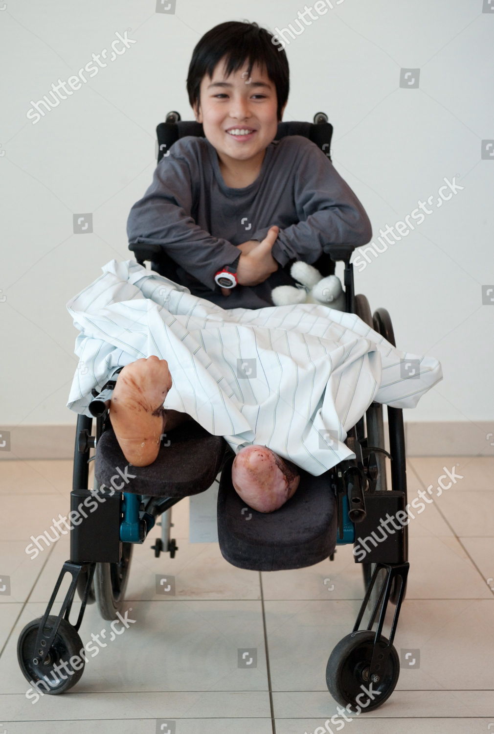 Nineyearold Afghan Boy Ali Smiles During Editorial Stock Photo - Stock ...