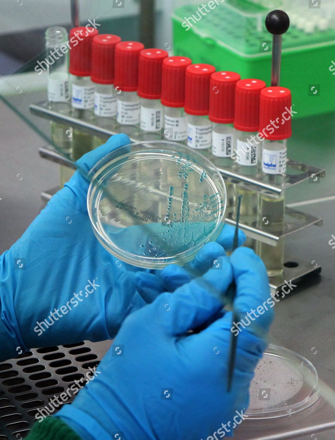 Laboratory Worker Test Samples Bacteria Lab Editorial Stock Photo ...