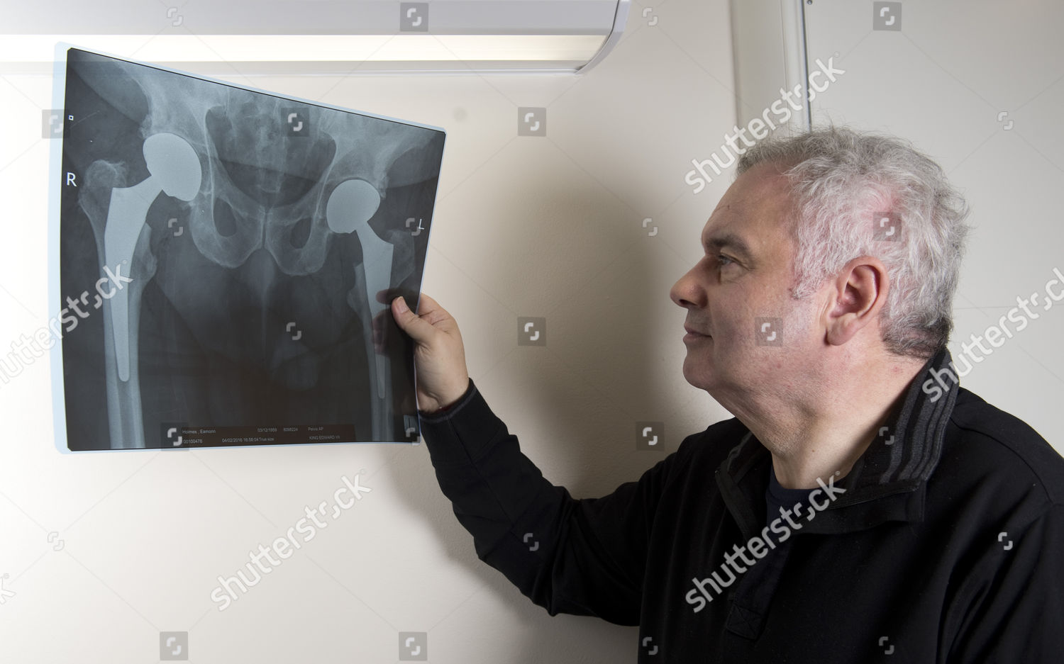 Eamonn Holmes King Edward Vii Hospital Editorial Stock Photo - Stock ...
