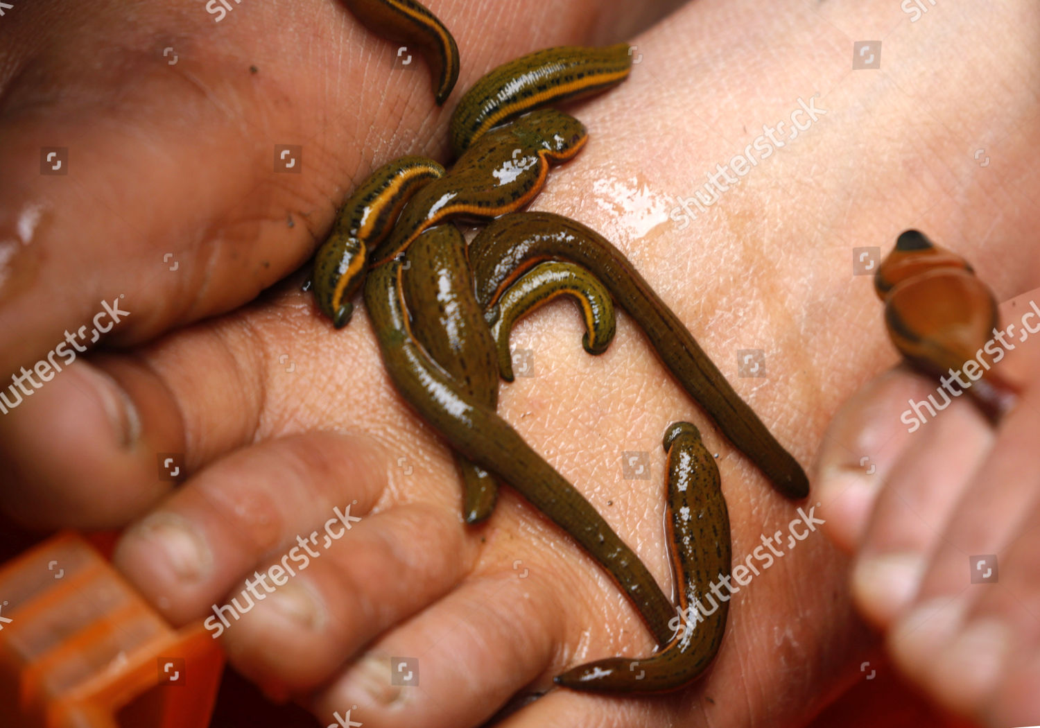 Leeches Suck Blood Foot Patient During Editorial Stock Photo - Stock ...