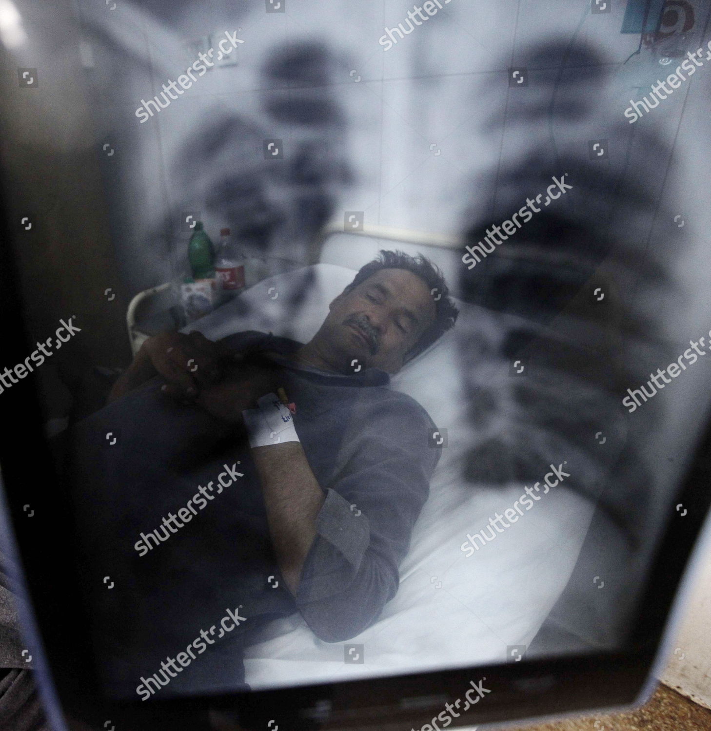 Patient Suffering Tuberculosis Tb Looks His Editorial Stock Photo ...