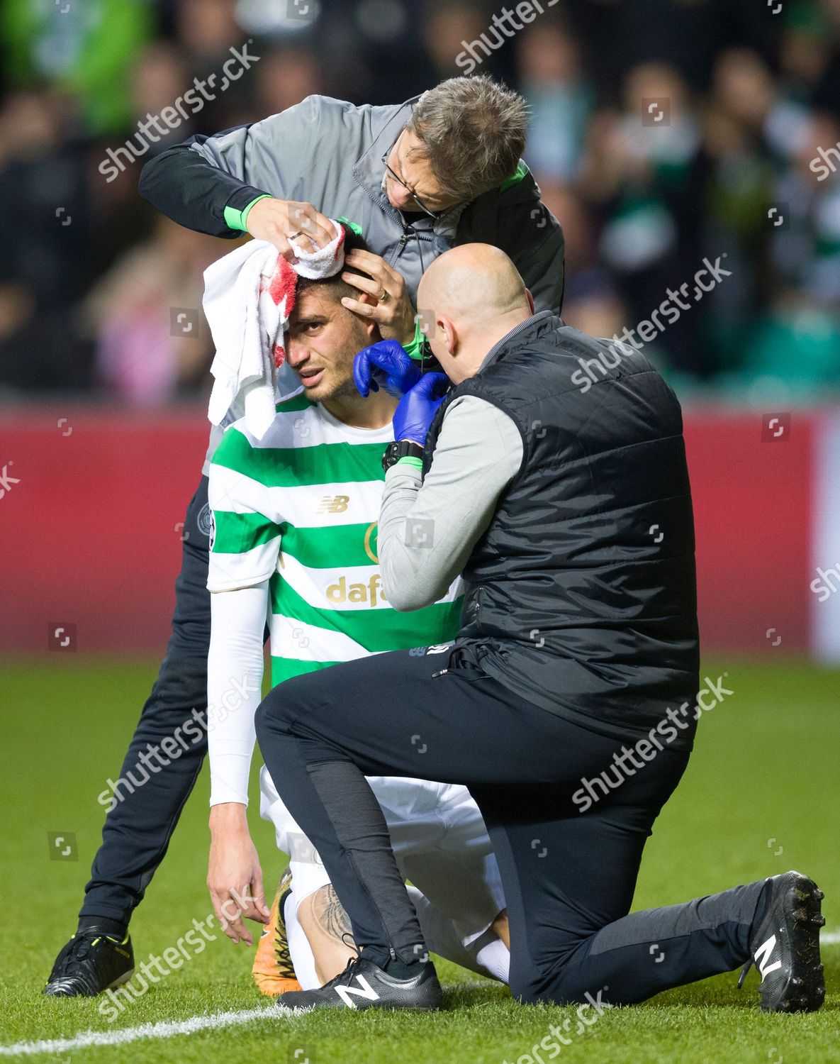Nir Bitton Celtic Gets Treatment Cut Editorial Stock Photo - Stock ...