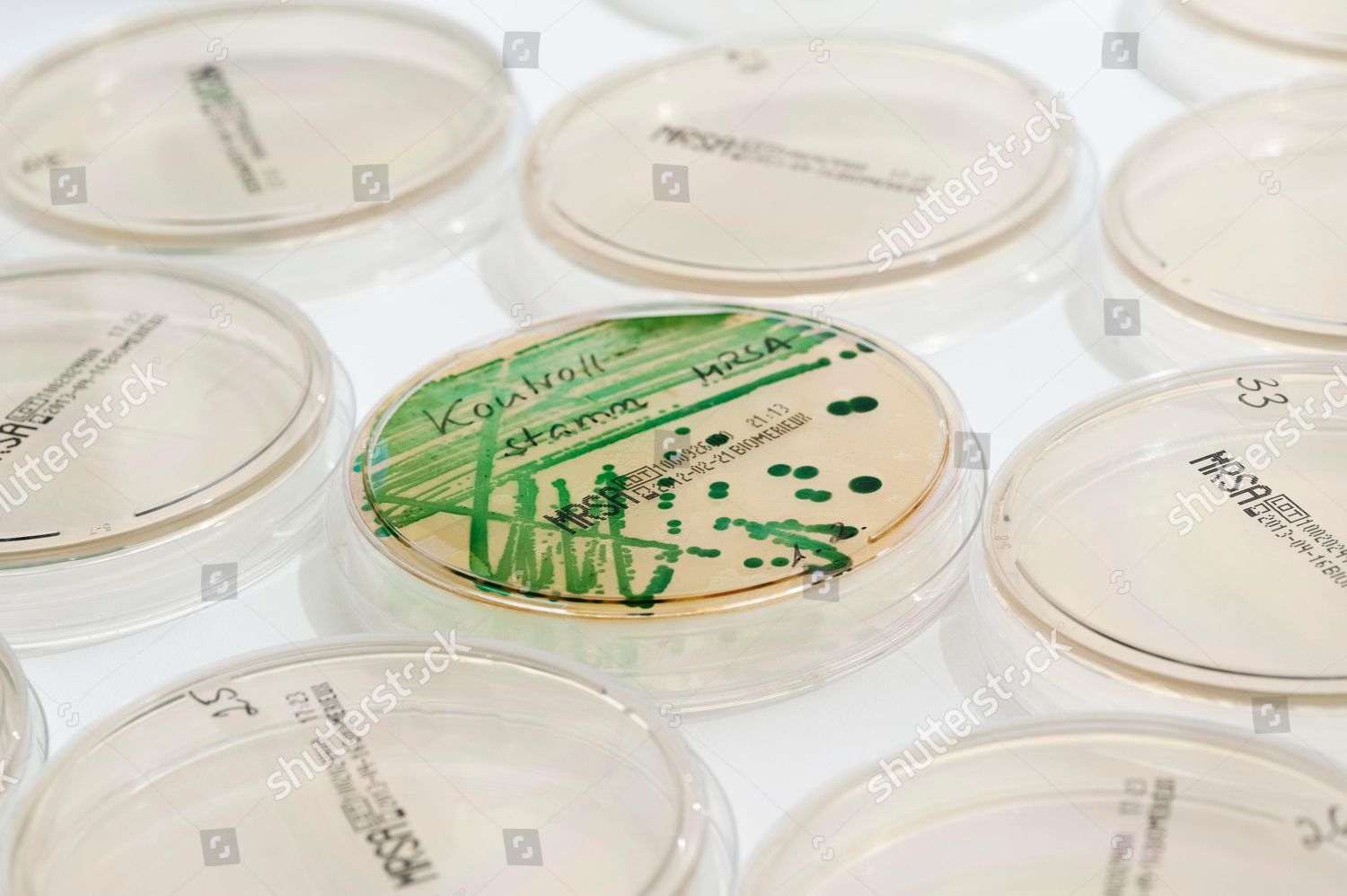 Microbiological Diagnosis Mrsa Bacteria Methicillinresistant ...
