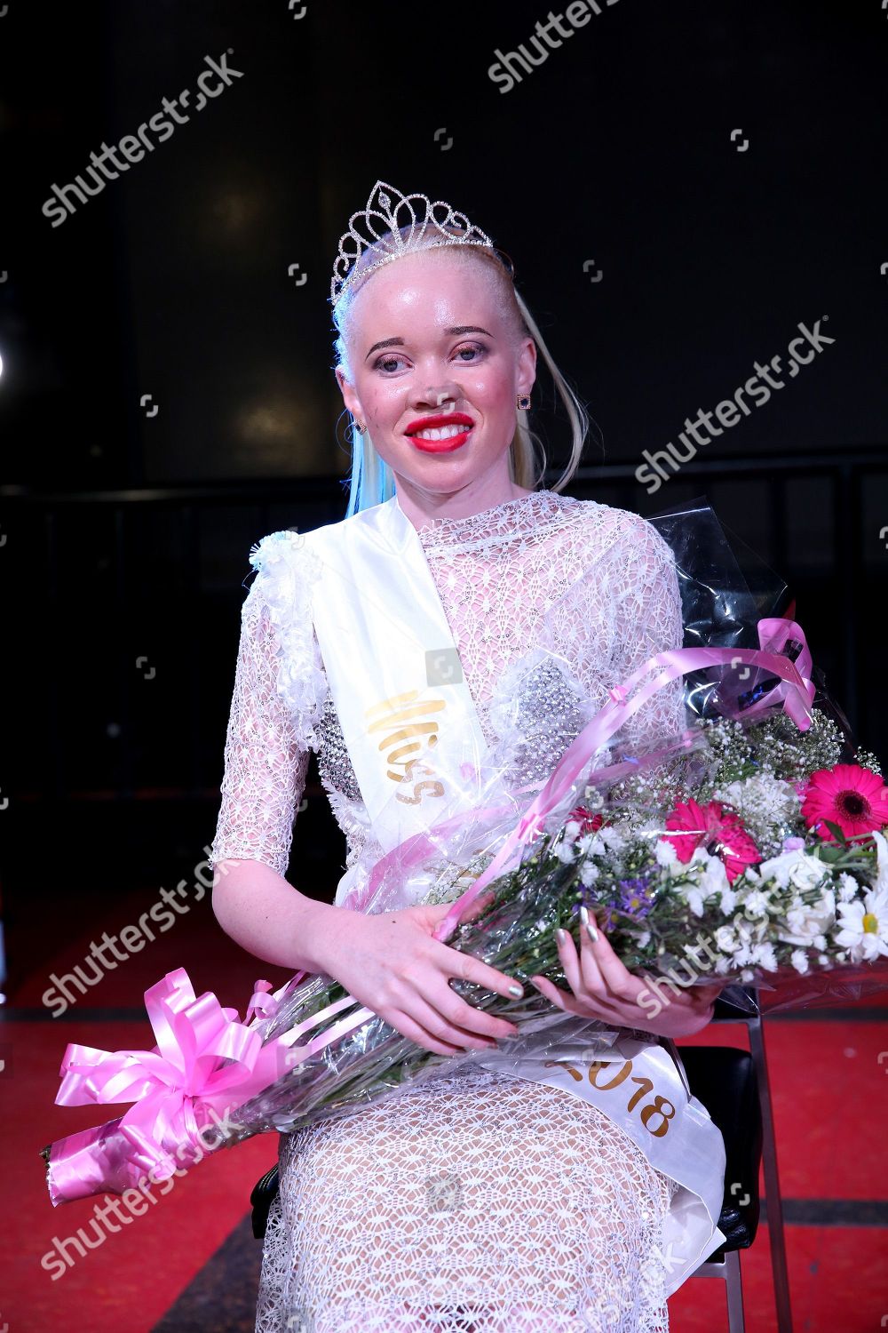 Miss Albinism Zimbabwe 2018 Winner Sithembiso Editorial Stock Photo ...