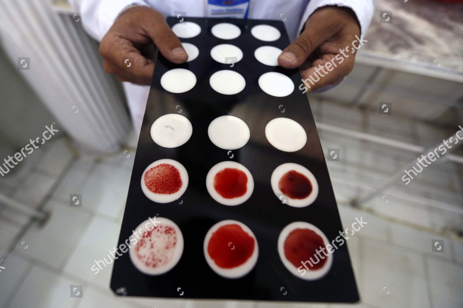 Laboratory Staff Sorts Blood Samples Blood Editorial Stock Photo ...