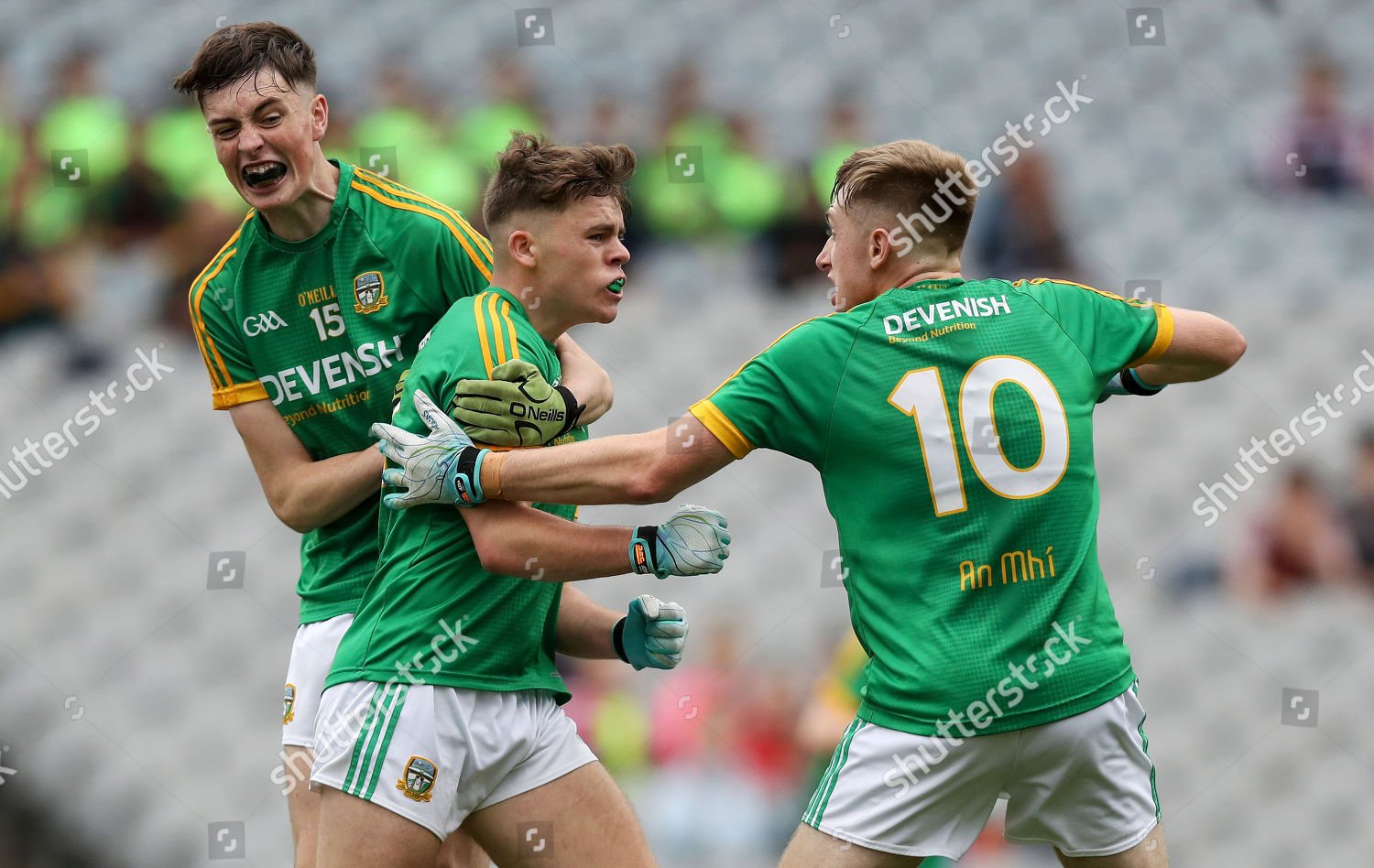 Galway Vs Meath Meaths Luke Kelly Editorial Stock Photo - Stock Image ...